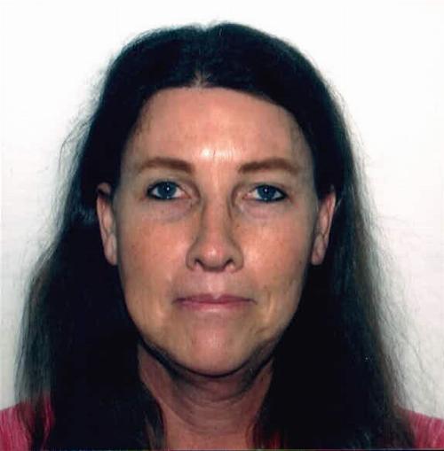 Find permanent hair removal in CA | American Electrology Association